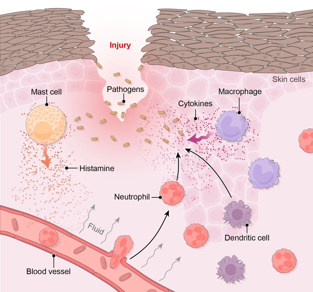 When is inflammation beneficial? - Examine